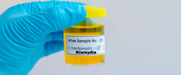 Klamydia | HelseSmart