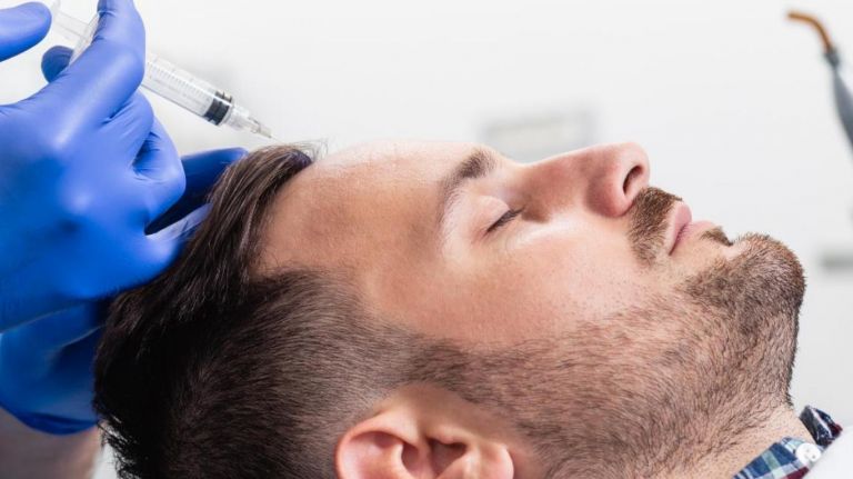 PRP behandling, PRP + Meso Hårtap hos Clinic Yvonne